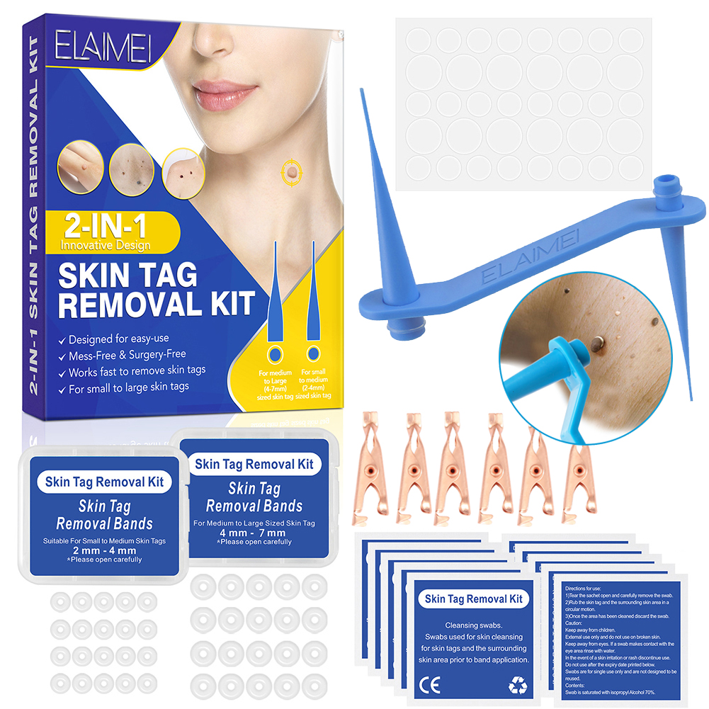 Skin Tag Remover Device for Large Mole Wart Removal with Removal Bands ...