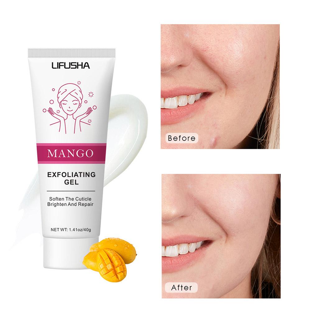 LIFUSHA Mango Exfoliating Gel Cream Face Exfoliators Brighten Repair ...