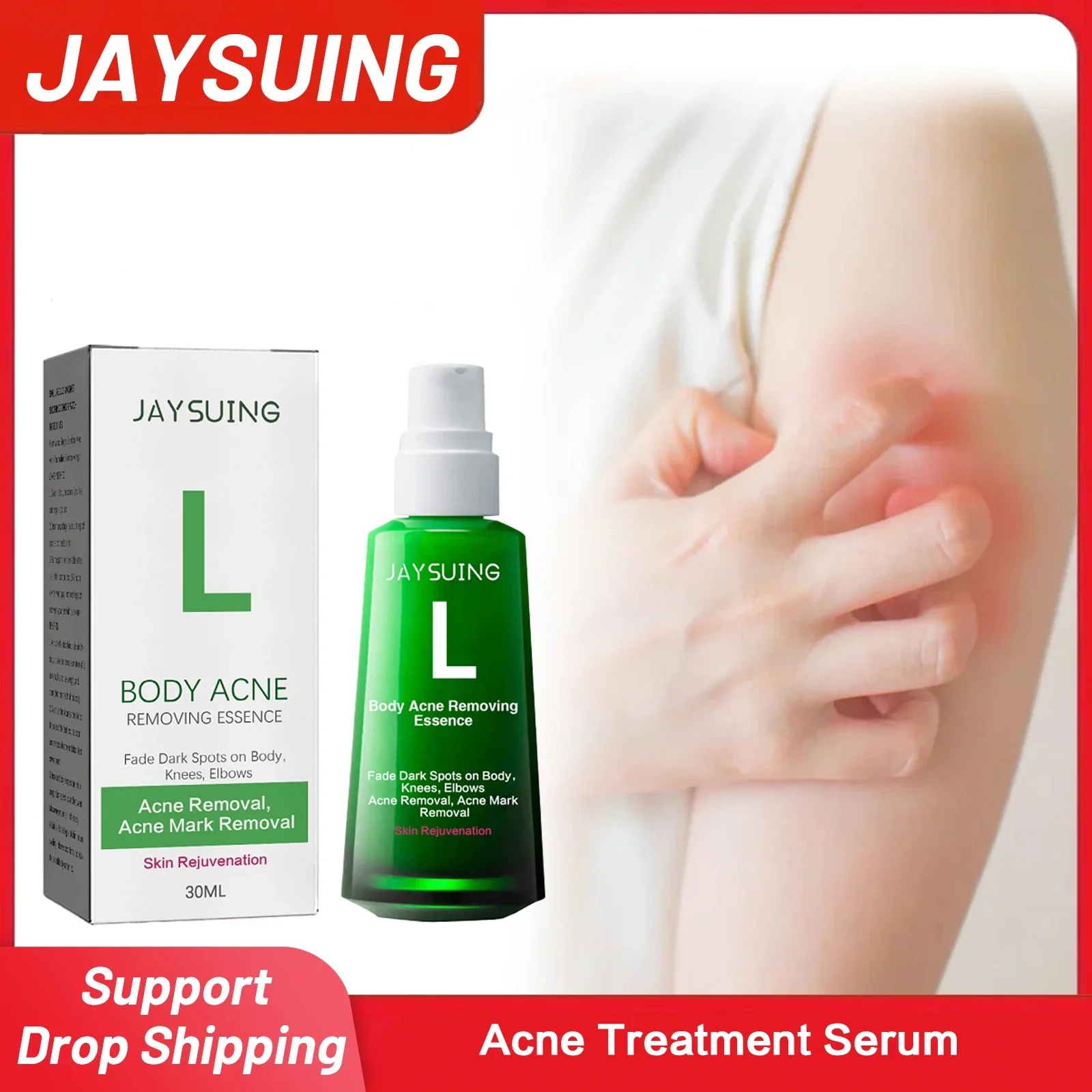 Acne Treatment Serum Remove Acne Marks Brighten Back Chest Buttock ...