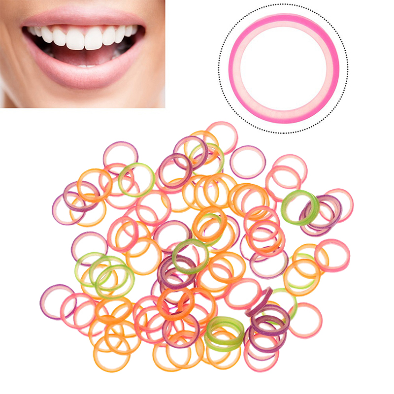 100Pcs Elastic Rubber Teeth Traction Rings Orthodontics Rubber Band ...