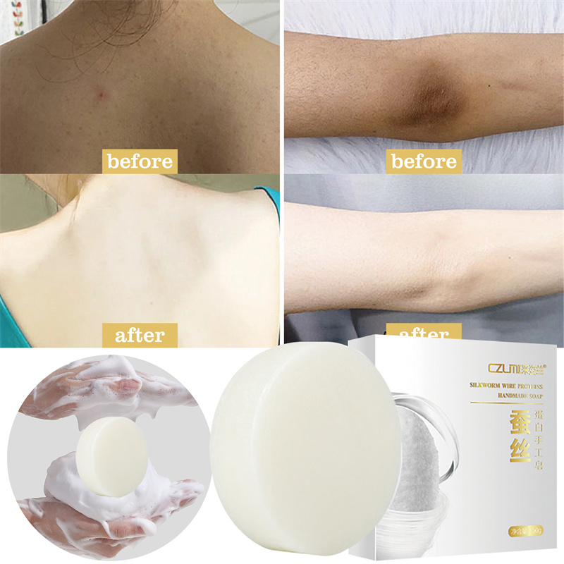 Body Lightening Soap Underarm Knee Bleaching Soap Dark Spot Tighten ...