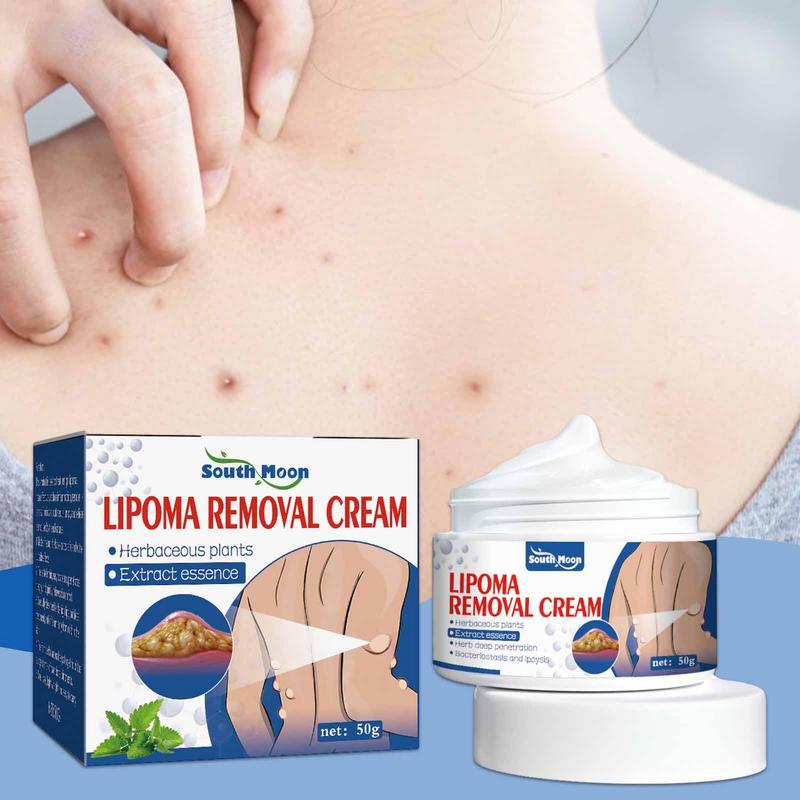 50g Lipoma Removal Cream The Whole Body Multiple Subcutaneous ...