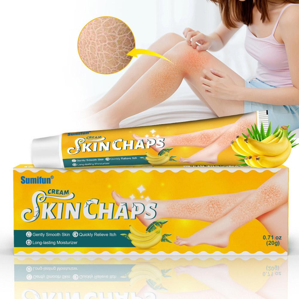 Removal Chicken Skin Cream Repair Dry Exfoliation Peeling Fish Care ...