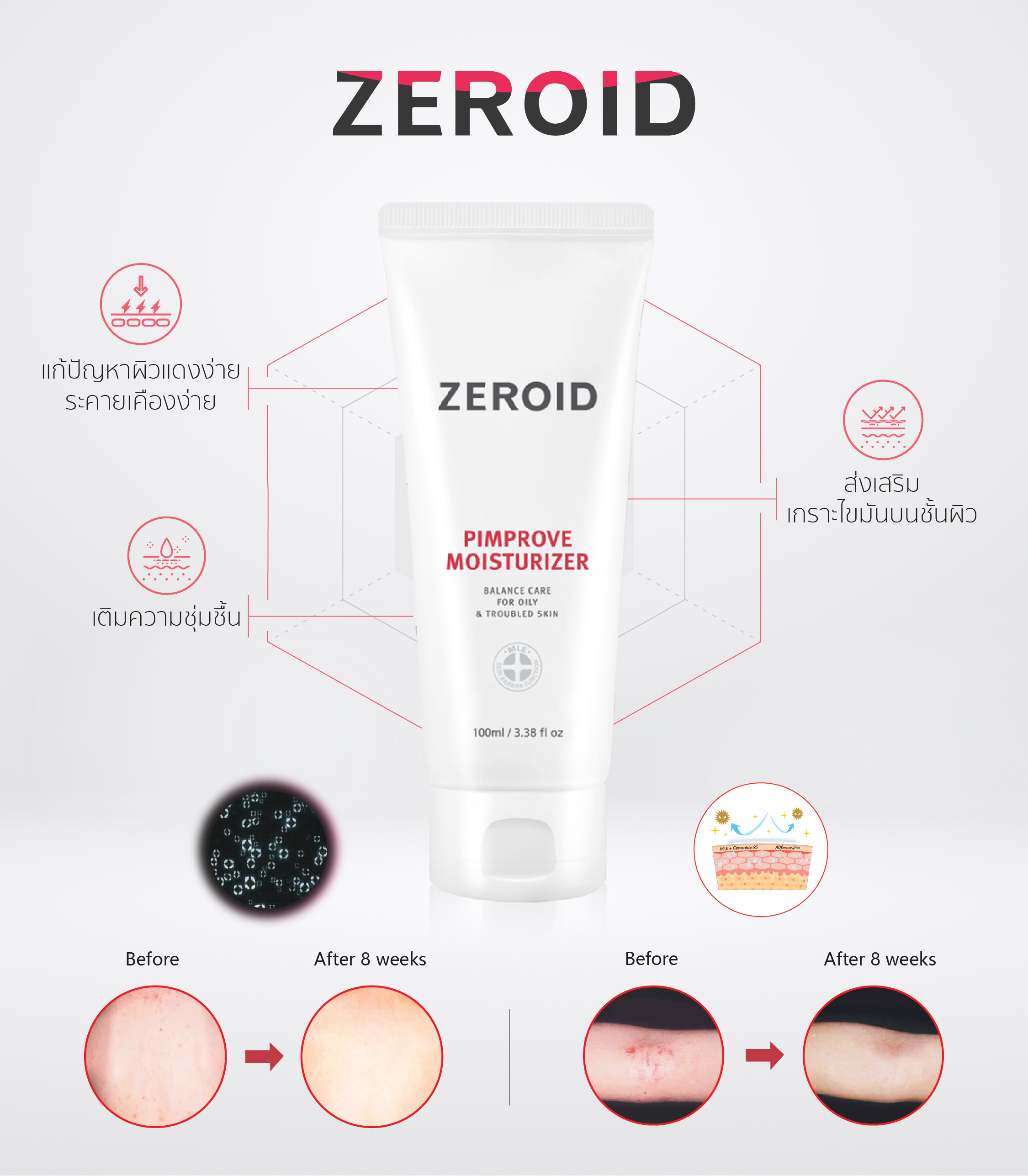 ซีรอย Zeroid Pimprove Moisturizer 100ml - ZeroidThailand - ThaiPick