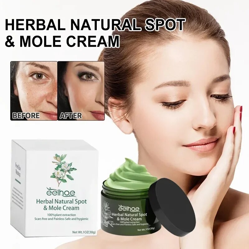 Anti freckle cream fade spots pimple improve dull Melanin remove Acne ...