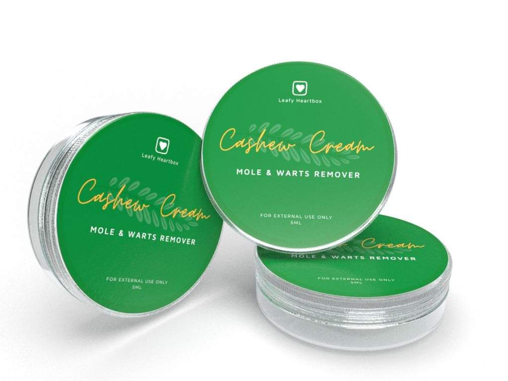 cashew cream/mole/warts/skin tags/milia/syringoma/kulugo Cashew Cream ...