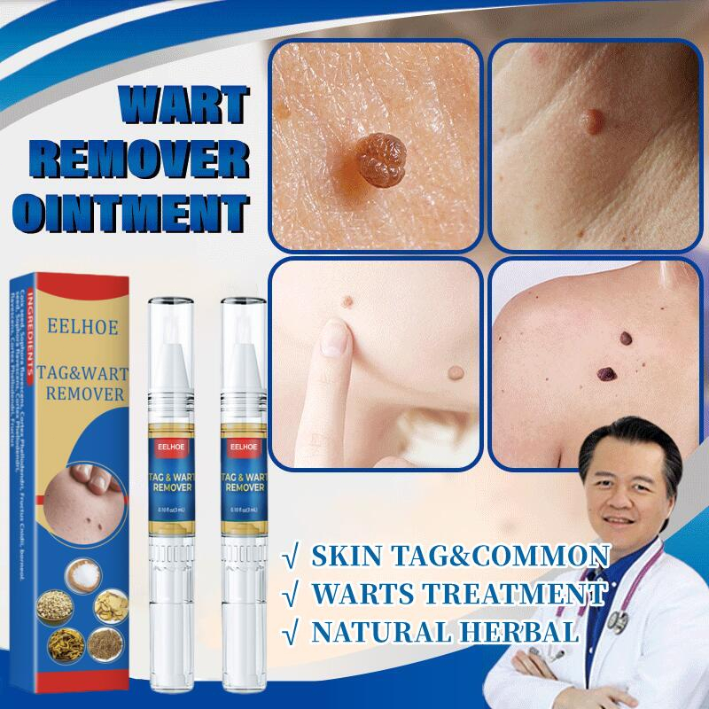 Wart Remover Pen Wart and Mole Remover Skin Tag Foot Corn Plantar Wart ...