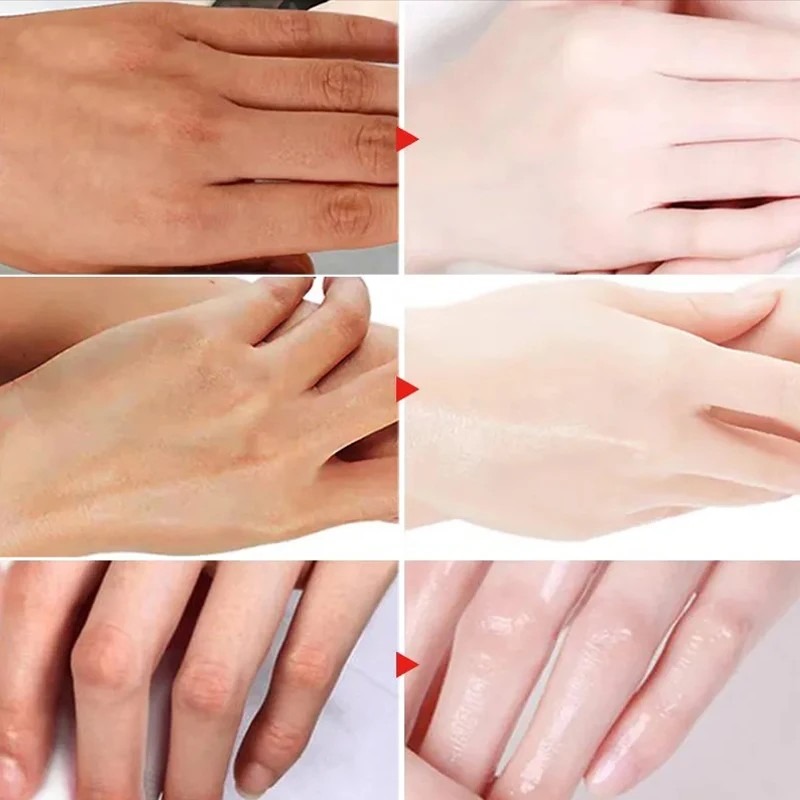 Vitamin C Brightening Cream For Dark Skin Brighten Intimate Areas ...