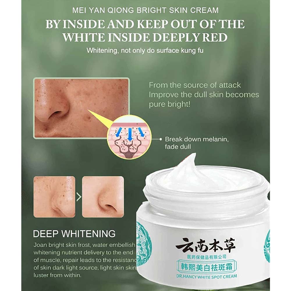 Yunnan Herbal Whitening Freckle Cream 20g Japanese Melasma Cream ...