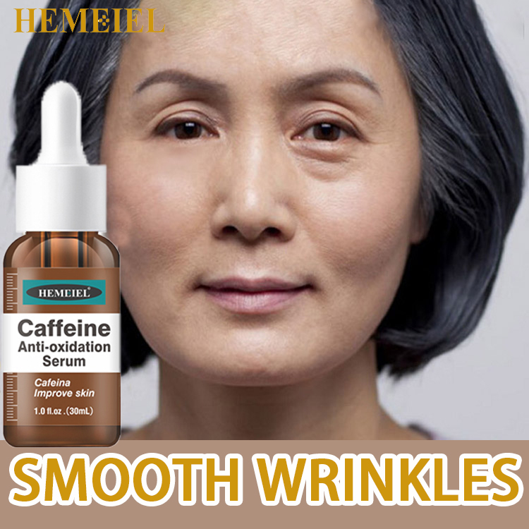 HEMEIEL Anti Acne And Pimples/Gamot Sa Pimples Cream/Pampatanggal Ng ...