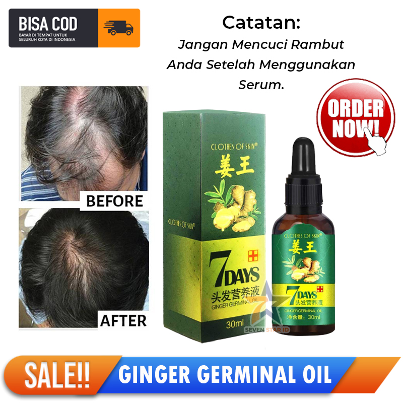 PROMO !! Minyak Penumbuh Rambut Rontok Anti Botak Pria Wanita Secara ...