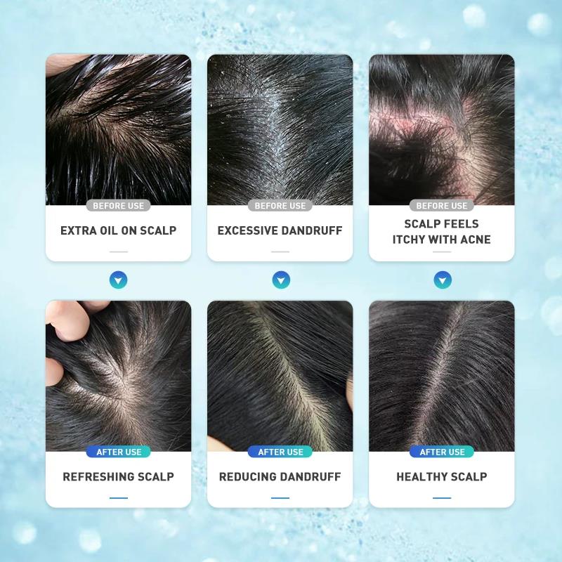 totoro New style 60g Hair Treatments Anti-Dandruff Exfoliating Shampoo ...