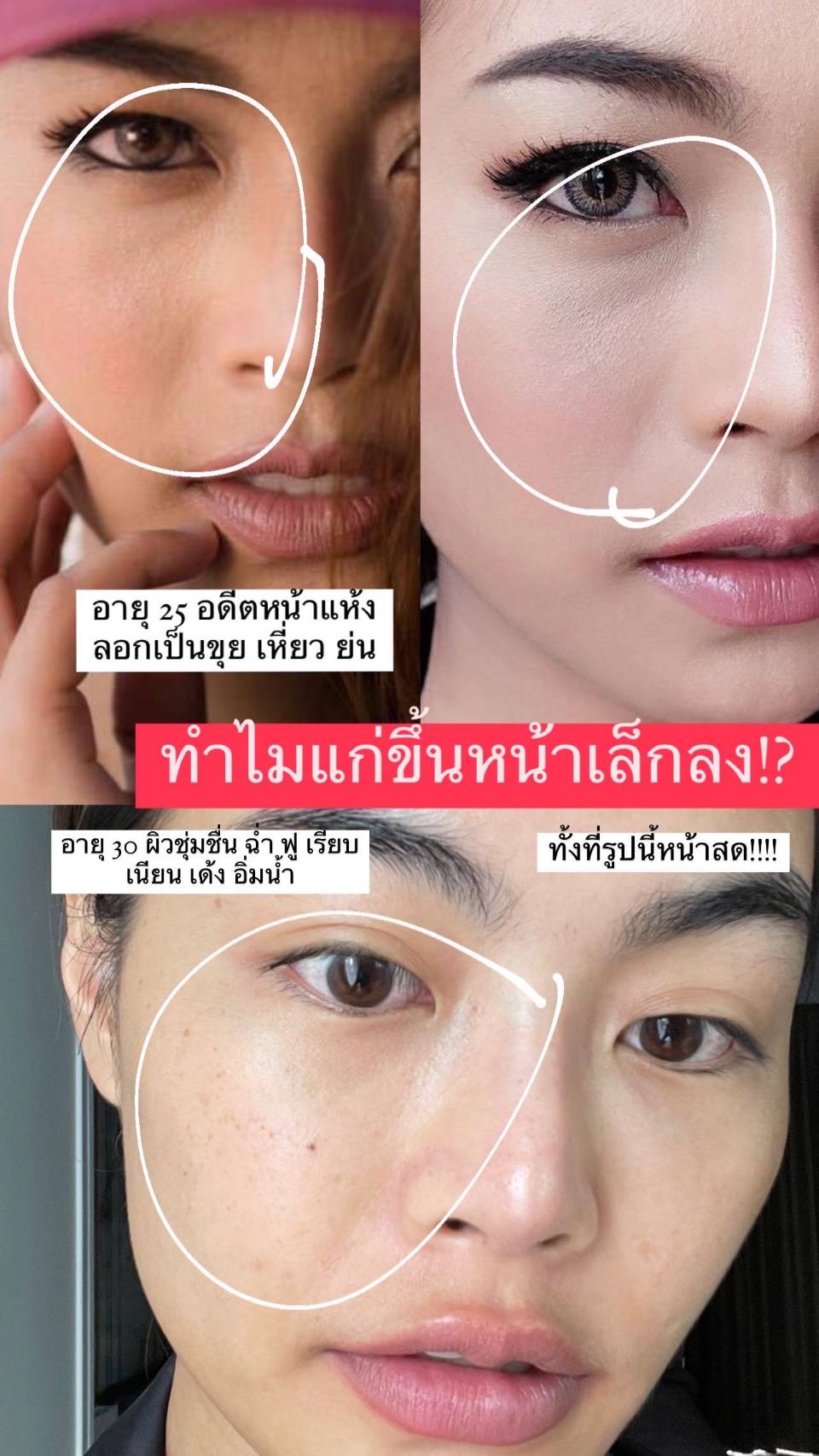 แท้ 100% เซรั่มไฮยา Haewon Hya Filler Anti Deep Wrinkle Enrich Serum ...