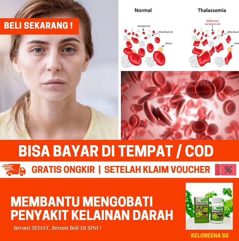 Obat Herbal Thalasemia - Thalasemia Mayor - Thalasemia Minor - Obat ...