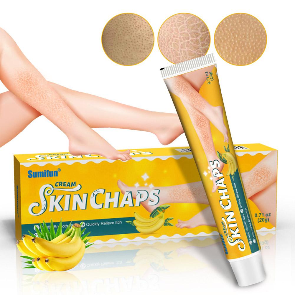 Removal Chicken Skin Cream Repair Dry Exfoliation Peeling Fish Care ...