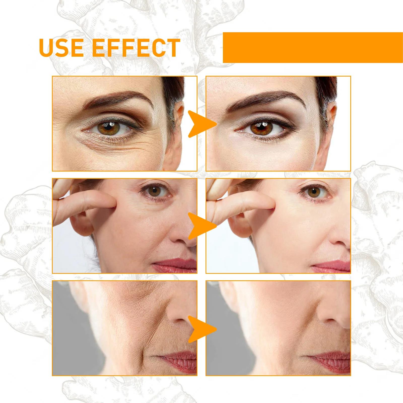 Turmeric Whitening Cream Original Dark Spot Correcting Melasma Freckle ...