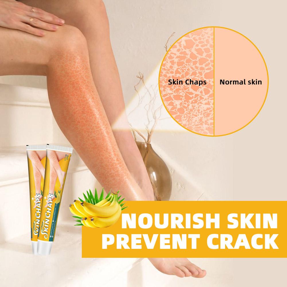 Removal Chicken Skin Cream Repair Dry Exfoliation Peeling Fish Care ...