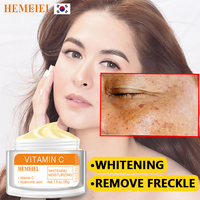 HEMEIEL Melasma Cream/Dark Spots Remover/Olee White Clean Melasma ...