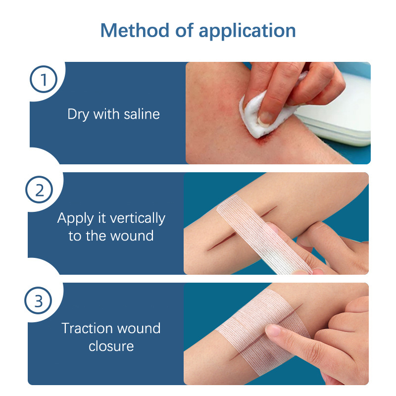 【linfang store】Skin Closure Strips Postpartum Wound Cosmetic Surgery ...