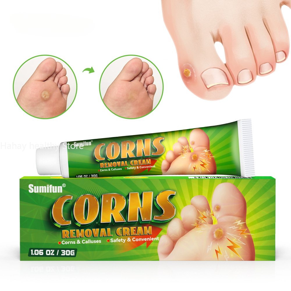 Foot Corn Remover Cream Chicken Eye Skin Infection Treatment Ointment ...
