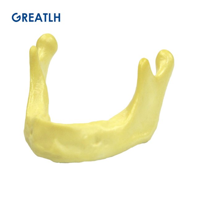 【High-quality】Dental Lower Jaw Model Mandibular Implant Model Dental ...