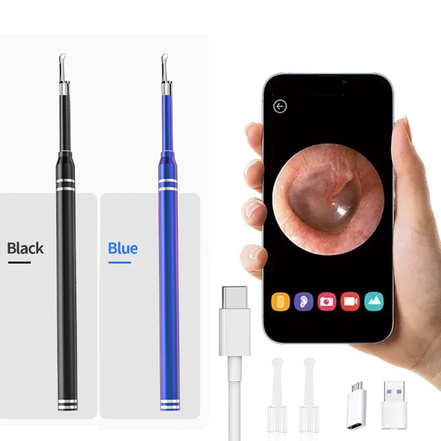 【Clearance Markdowns】 HD Ear Cleaner Camera Otoscope Video In Ear ...