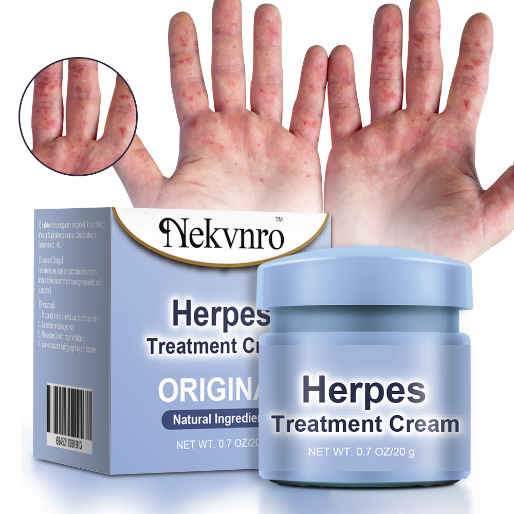 Nekvnro Herpes Cream 20g Treatment Genital Herpes Zoster Cream Natural ...
