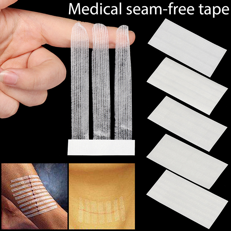 4Bags Wound Skin Closure Strips Adhesive Suture Free Tape Postpartum ...