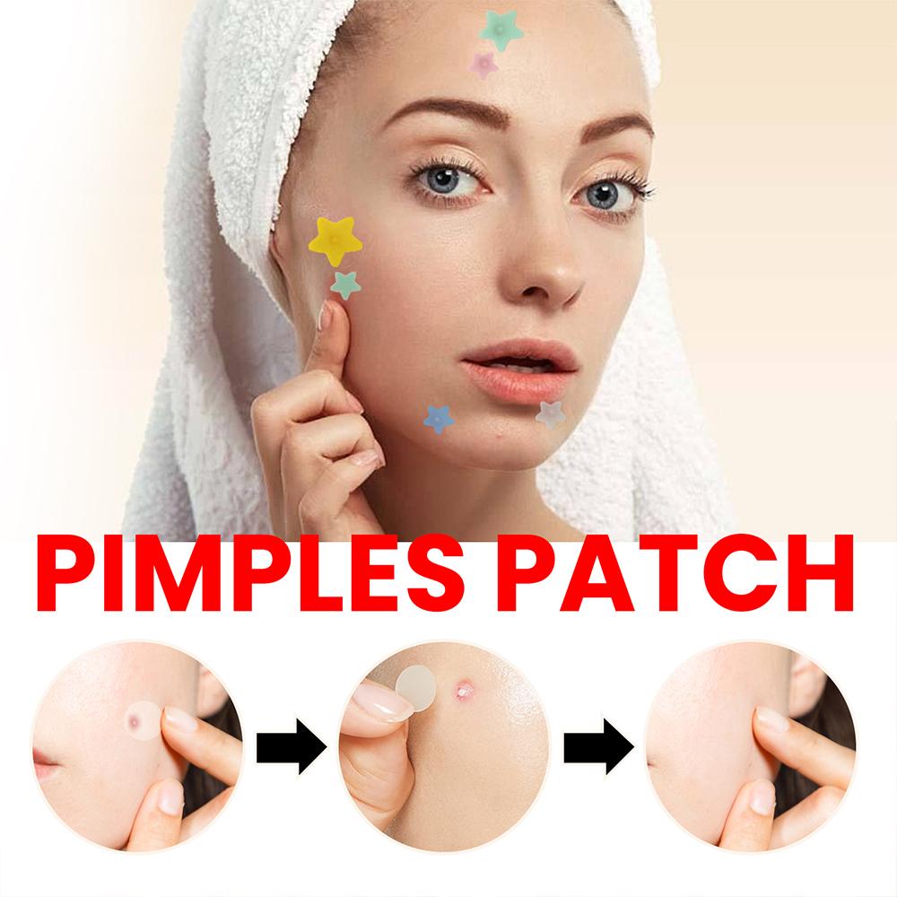 200 Patches Acnes Pimple Patches for Zits and Blemishes,Spots ...
