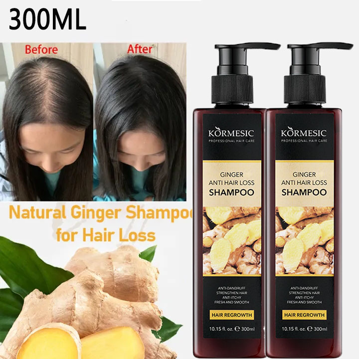 Shampo penumbuh rambut cepat Anti rambut rontok Botak ginger shampoo 300ml kontrol minyak ...