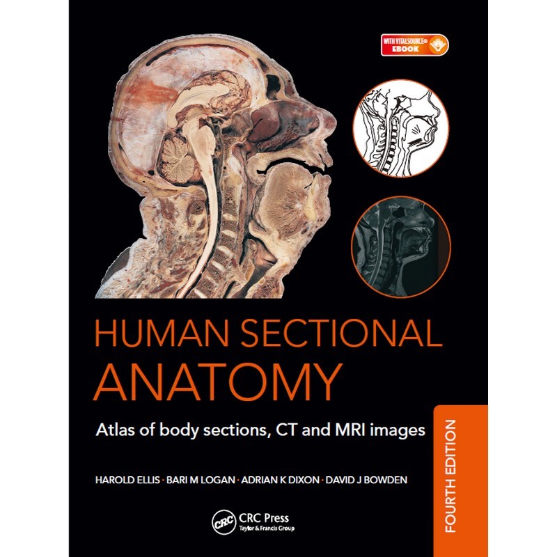 Human Sectional Anatomy: Pocket atlas of body sections, CT and MRI ...