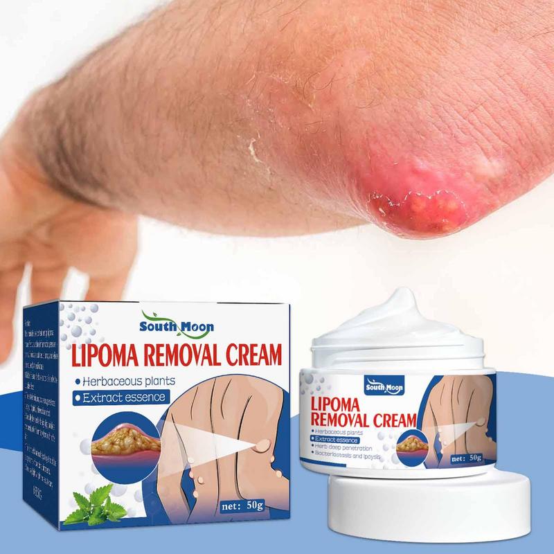 50g Lipoma Removal Cream The Whole Body Multiple Subcutaneous ...
