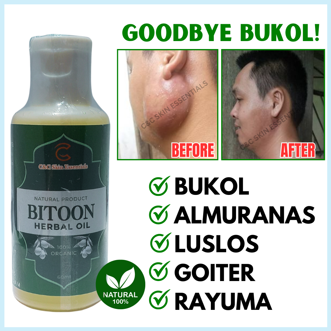 Original Bitoon Herbal Oil 60ML: Effective Gamot sa BUKOL, CYSTS, TUMOR ...