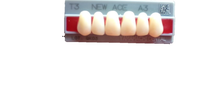 New Ace Acrylic Resin Shade A3 T1,T2,T3,T4, T5 & T6 | Lazada PH