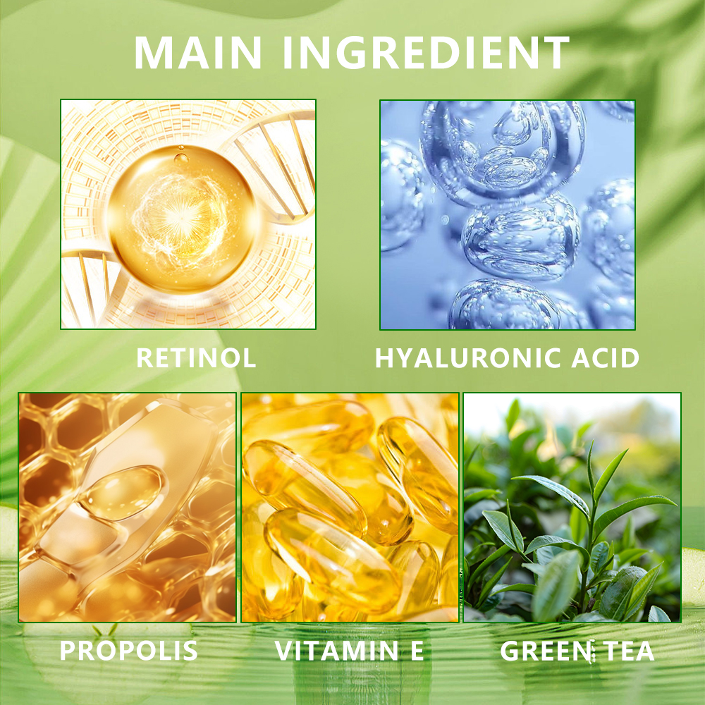 Beauty Cream Body Lightens Brightens Cream Armpit Legs Knee Elbow Bleaching Remove Dark Spots ...