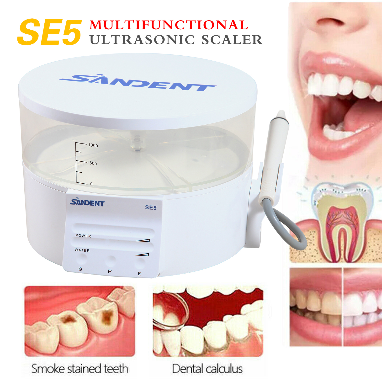 Somnus feng SANDENT Dental Ultrasonic Scaler fit EMS Cavitron Endo ...