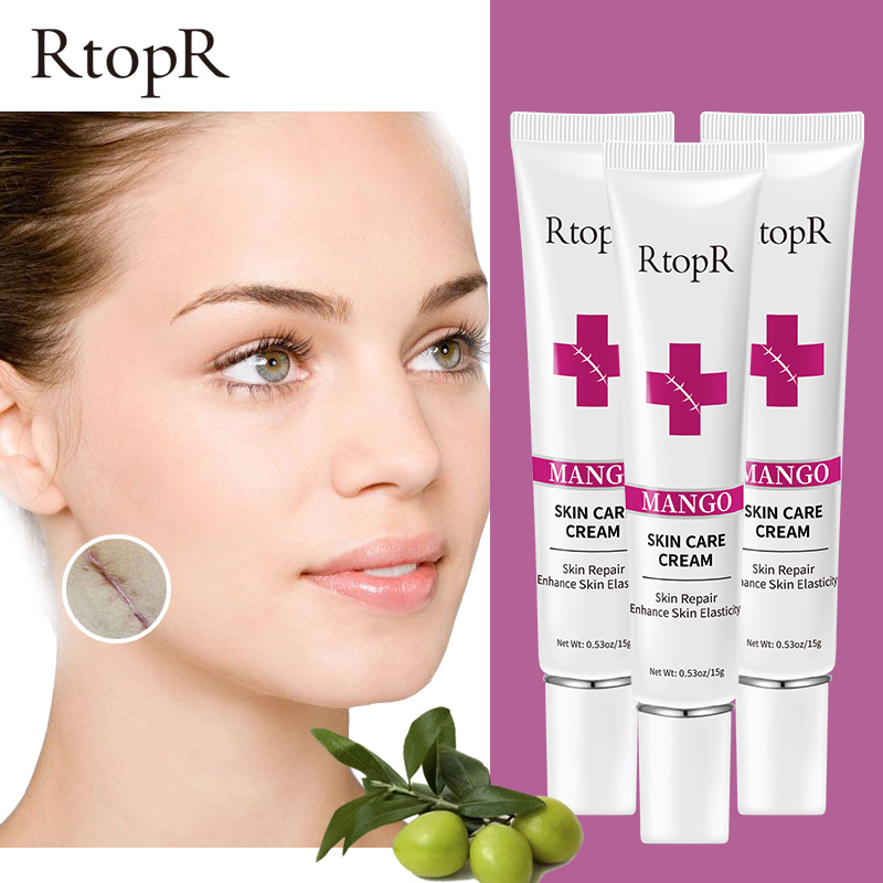 RtopR 3PCS MANGO SCAR REPAIR CREAM Acne Scar Treatment Face Face Cream ...