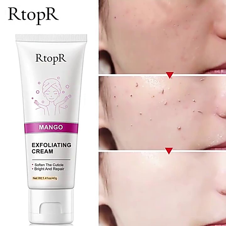 RtopR Facial Exfoliating Cream สครับขัดผิวครีมขัดผิวหน้ามะม่วผลิตภัณฑ์ ...