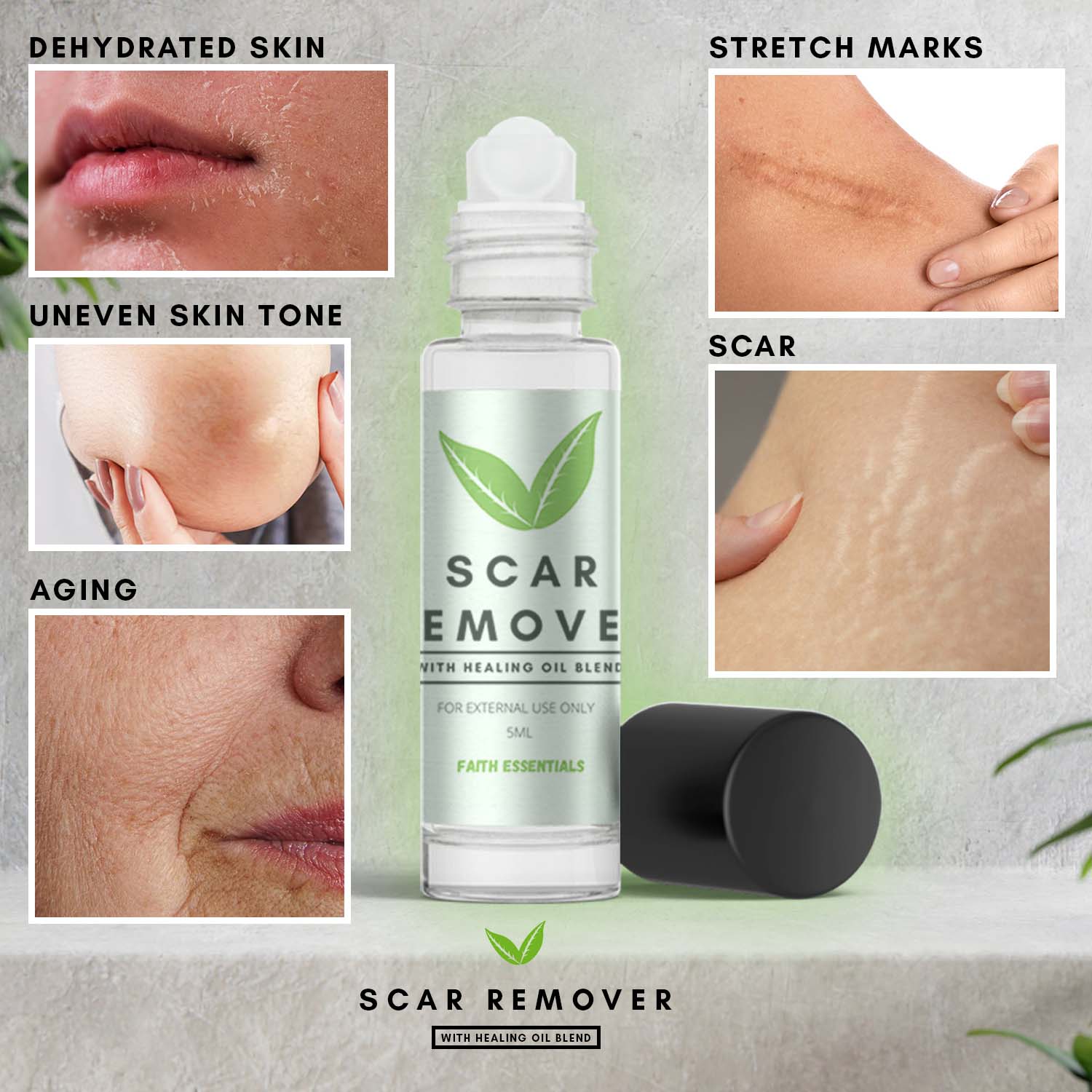 Scar Remover with Healing Oil Blend - Stretch Marks Remover, Uneven ...