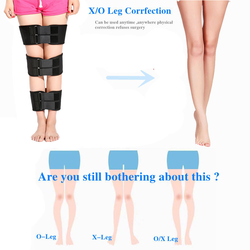 3pcs/set Effective O-leg X type leg bowed Legs Knee Valgum ...