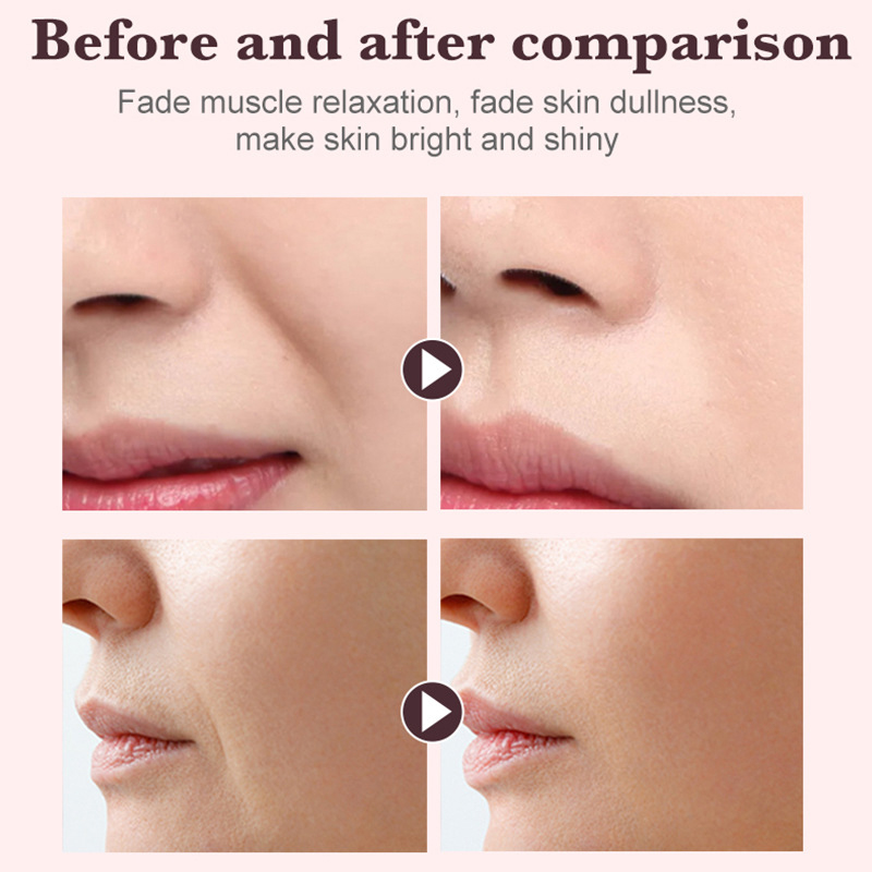 1Pair Nasolabial Wrinkle-removing Silicone Pads Face Anti-aging Sticker ...