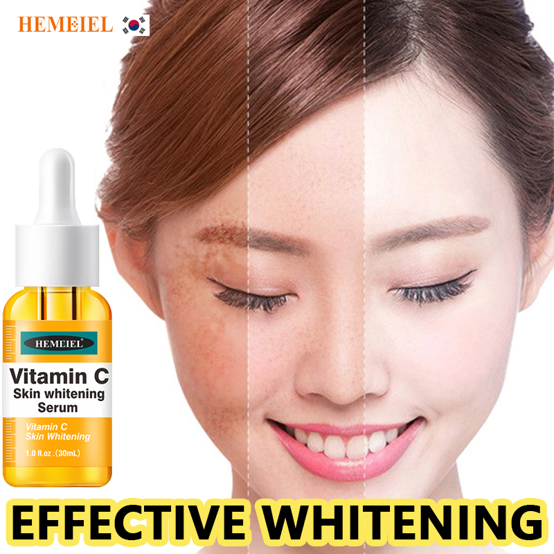 HEMEIEL Gamot Sa Pimples Cream/Pampatanggal Ng Butas Butas Sa Mukha ...