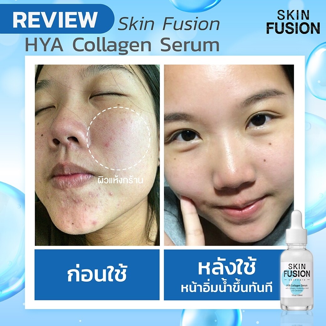 1แถม1 SKIN FUSION คอลลาเจน เซรั่ม Hya Collagen Serum เซรั่มหน้าใส ครีมบำรุงผิวหน้า ครีมทาหน้า ...