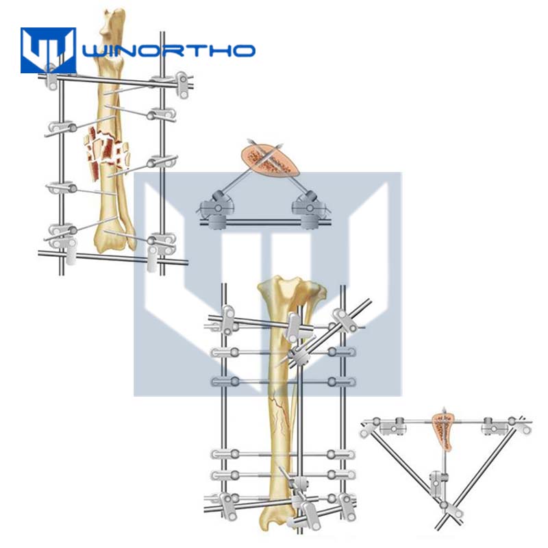 NEW 【Innovative design】Mini Sk Single Clamp For Veterinary Orthopedic ...
