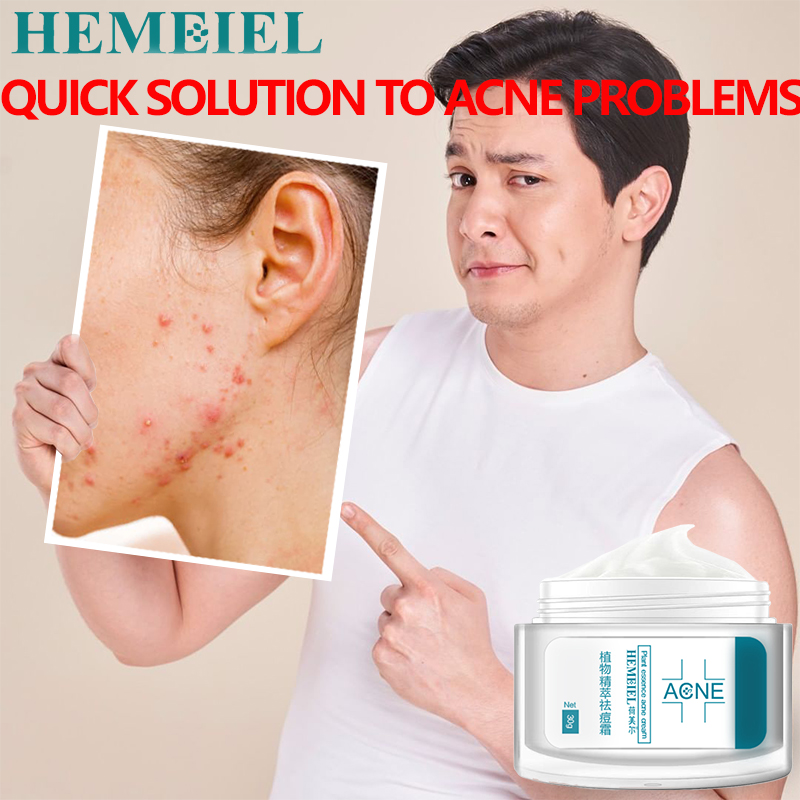 HEMEIEL Hair Removal Cream/Pubic Hair Removal/Hair Removal For Underarm ...