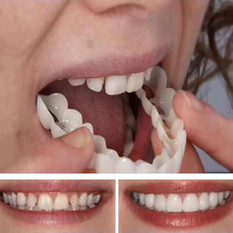 NEW 【Unique features】3PCS Denture Teeth Cover Comfort Fit Snap On ...