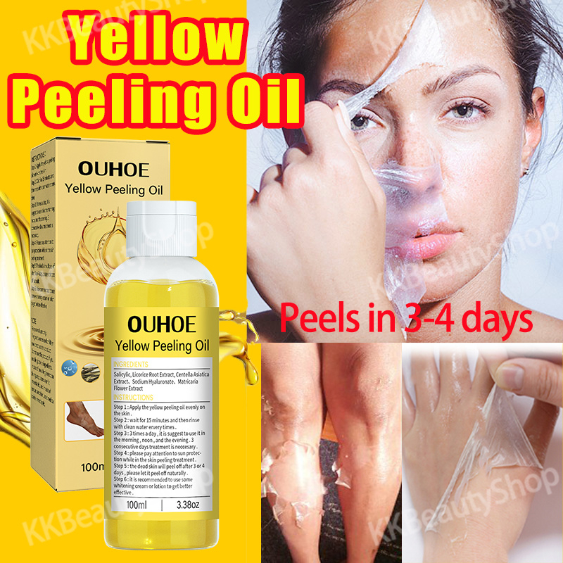 100ML Yellow Peeling Oil Skin Peeling Body Underarm Peeling Lotion ...