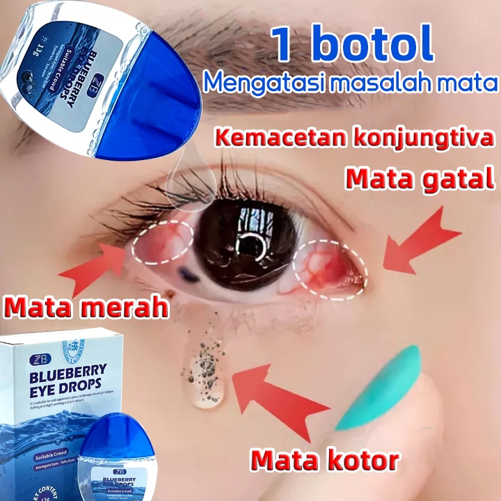 OBAT MATA MINUS /TETES MATA MINUS/ KATARAK/ SILINDER/OBAT MATA PENURUN ...