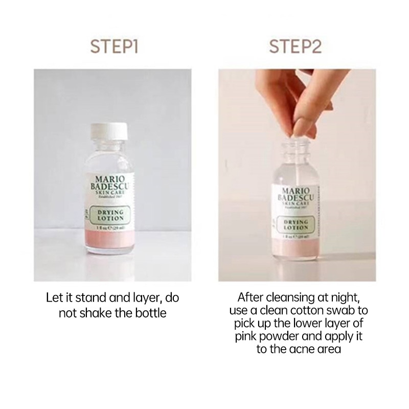 Acne Scar Removing Serum Drying Lotion Zinc Salicylic Acid Acne Pimple ...