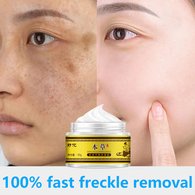 【Local delivery 】Melasma Removal Cream Original melasma and dark spot ...